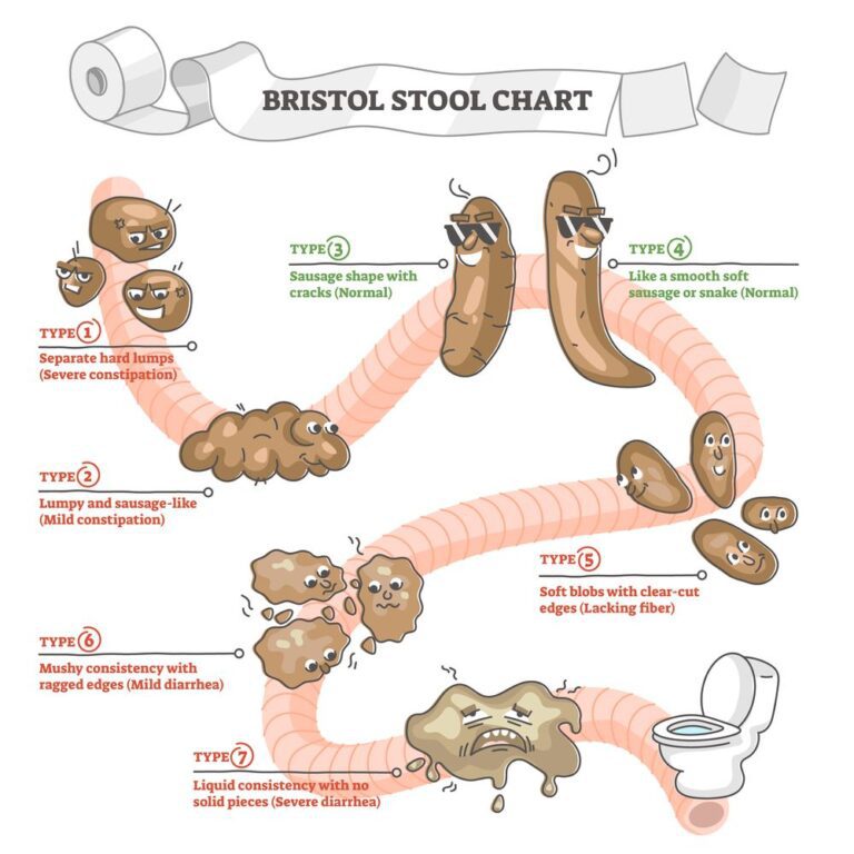 What do different colours of stool mean for your body?