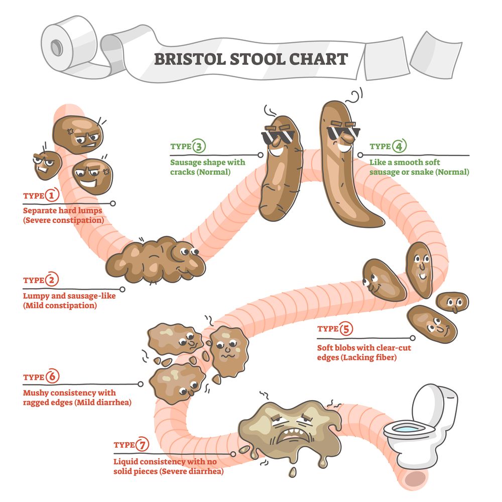 What do different colours of stool mean for your body?